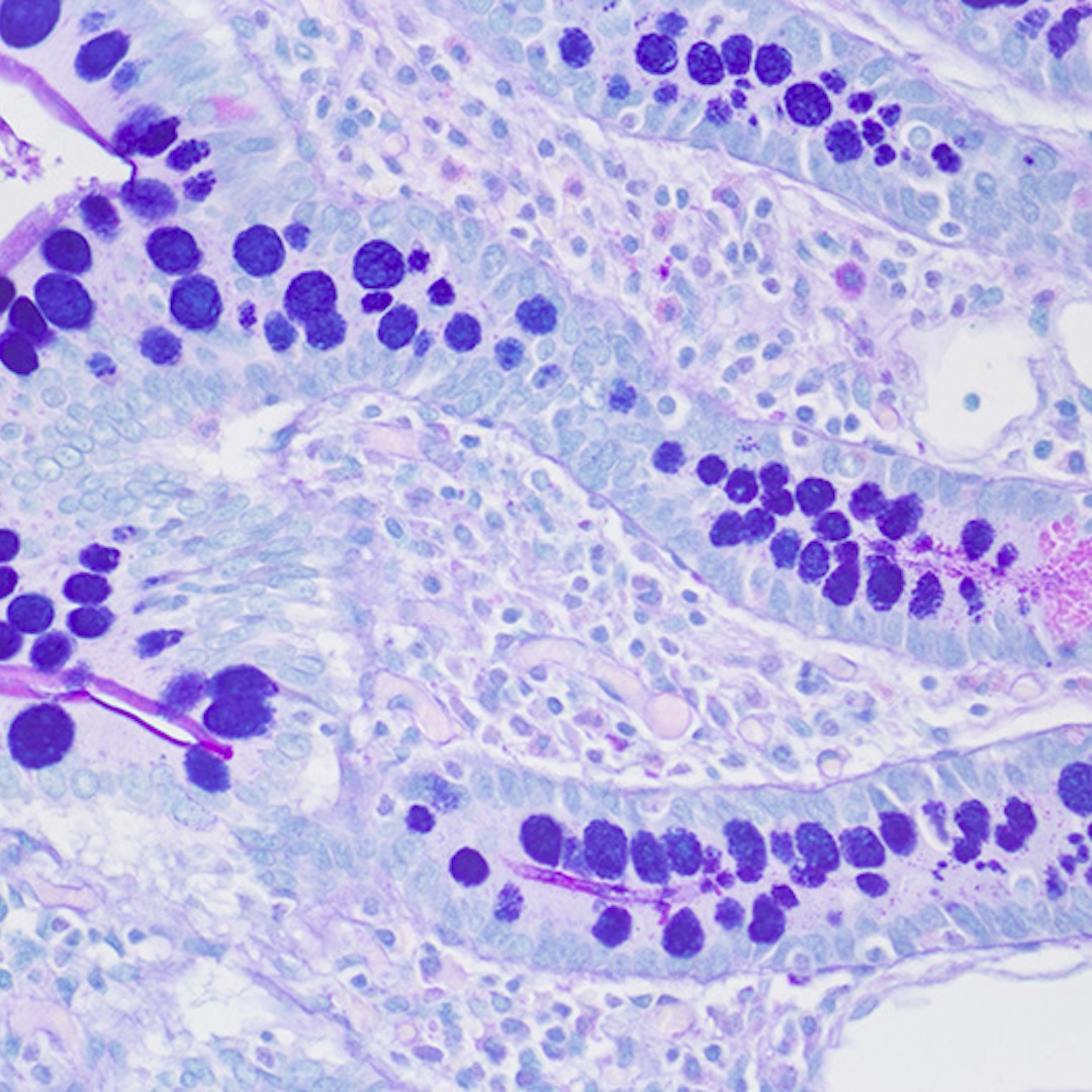 Control Slides Archives - Mortech Manufacturing